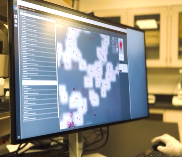 Macula Vision Systems Shines in Prestigious Global Competitions, State ...